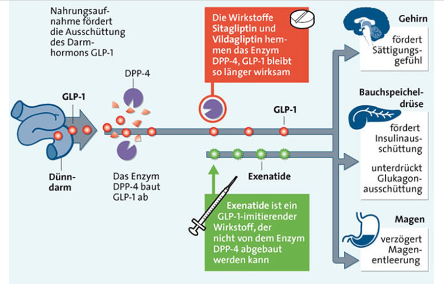 GLP-1-Analoga? | Diabetes I | Repetico