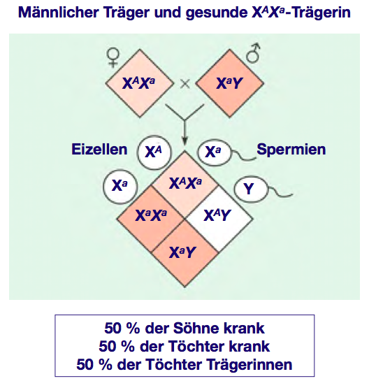 Vererbung X-chromosomaler rezessiver Merkmale (2 Beispiele)…