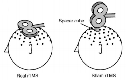Experimentaldesign & Sham-Stimulation 1. Was ist ein Prob…