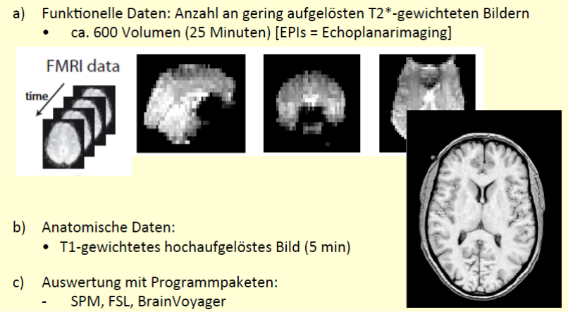 Datenanalyse - Die fMRT-Daten 1. Was umfasst die funktion…