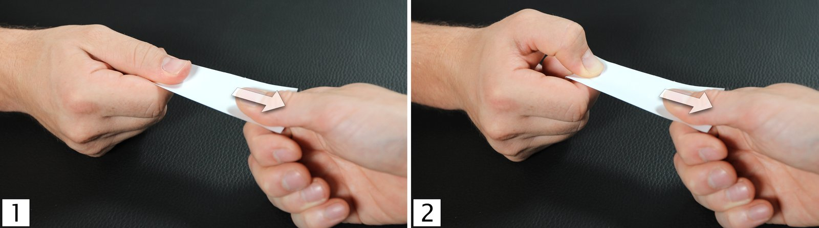 Froment-Zeichen | Amboss Abfrage | Repetico