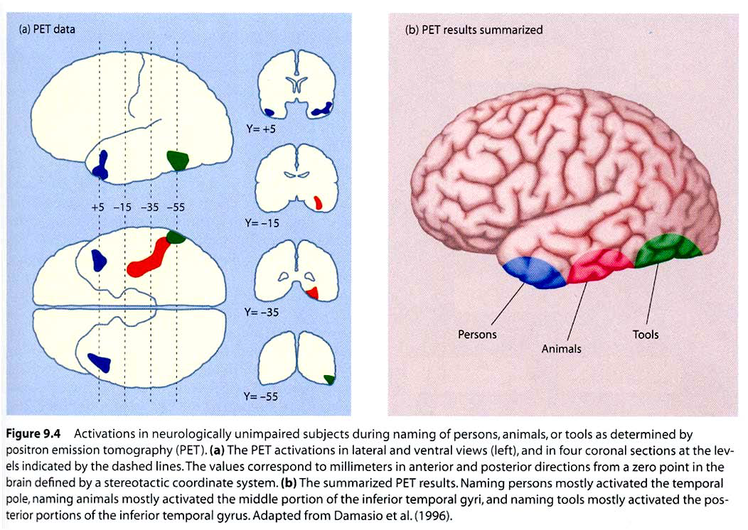 Beschreiben Sie die beiden Modelle die das Wernicke Geschwi…