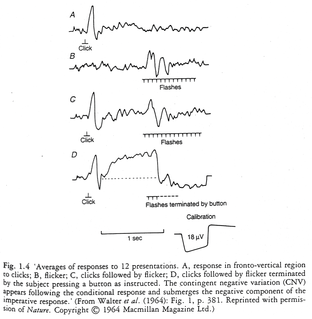 Was ist die CNV? | BiologischePsychology | Repetico