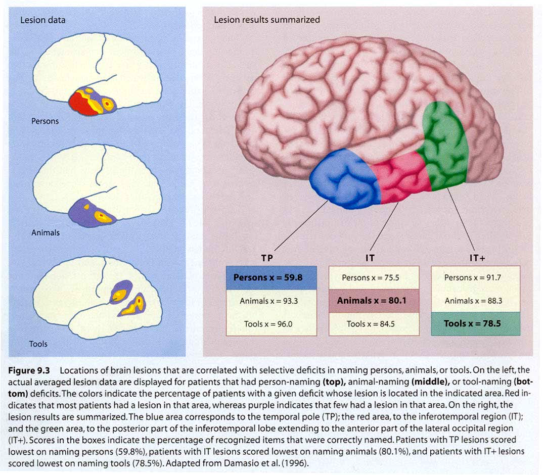 Beschreiben Sie die beiden Modelle die das Wernicke Geschwi…