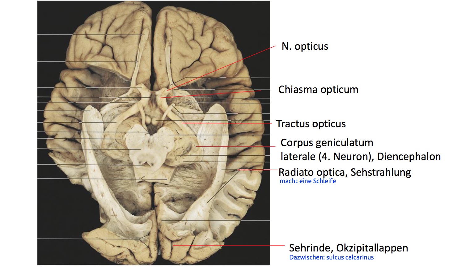 Sehbahn Welches Brodmann-Areal sind primäre und sekund ...