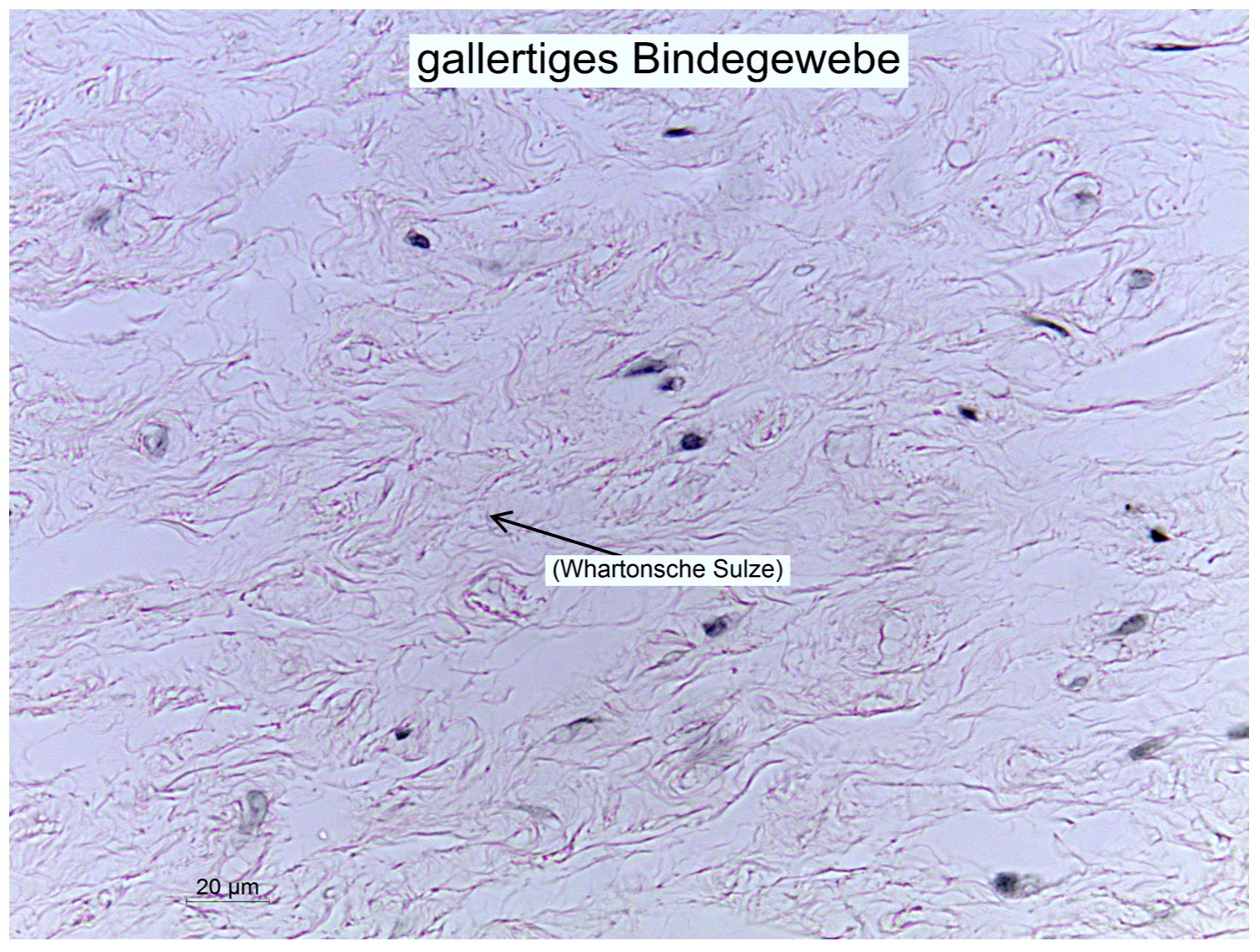 Gallertiges Bindegewebe. Was ist Wharton-Sulze? | Histologi…