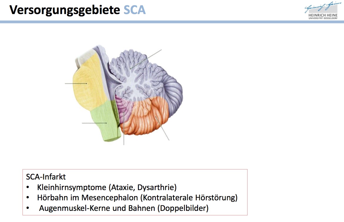 Welche Arterie? Welches Versorgungsgebiet?Was passiert b ...