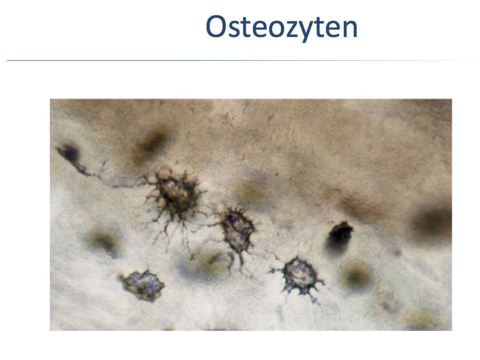 Welche Knochenzellen gibt es? | Histologie: Knochen und Knorpelgewebe ...