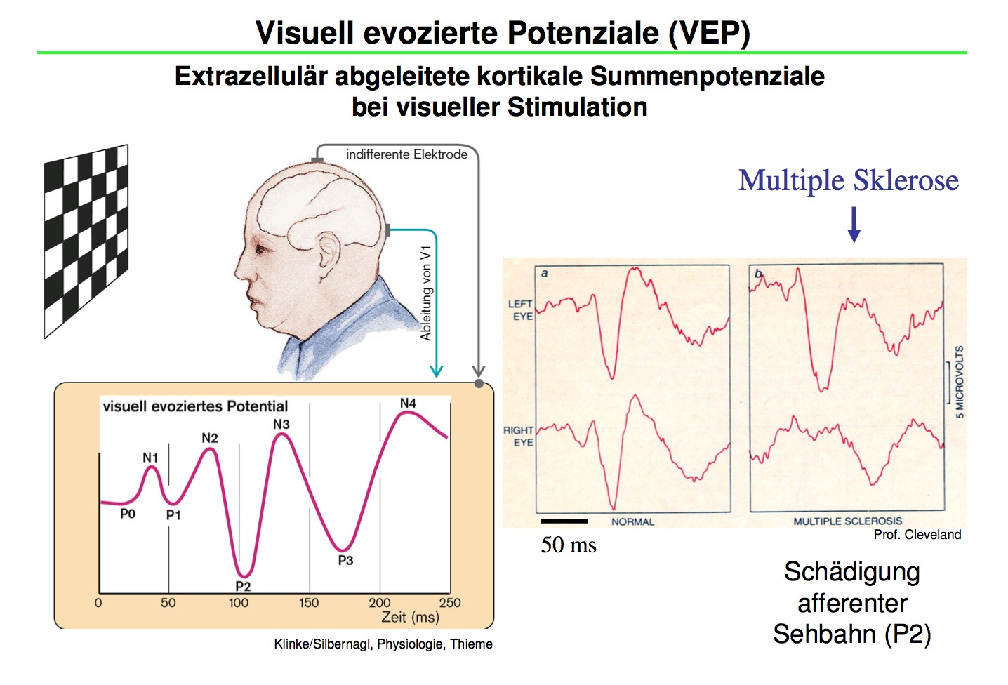 Evozierte Potentiale