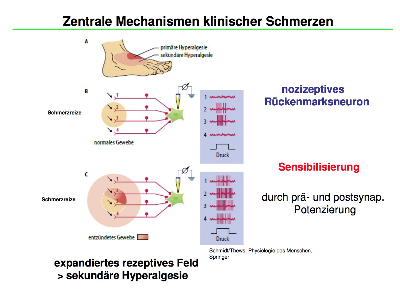 Zentrale Mechanismen klinischer SchmerzenWas versteht ma ...