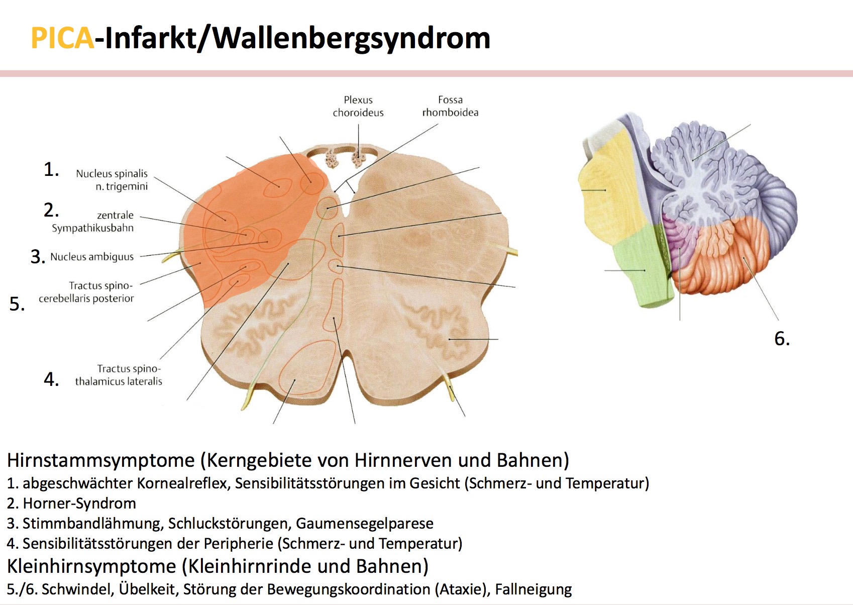 PICA-Infarkt/Wallenbergsyndrom2 Arten von SymptomenBeisp ...