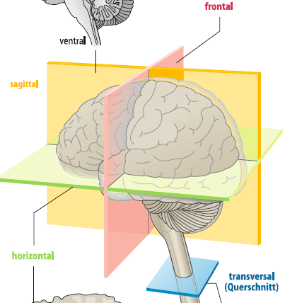 Die drei Schnittebenen sind ... | M3b - Biopsychologie | Re…