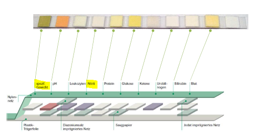 Urinstatus Teststreifen (Felder, 10) | Klinische Chemie (Hu…