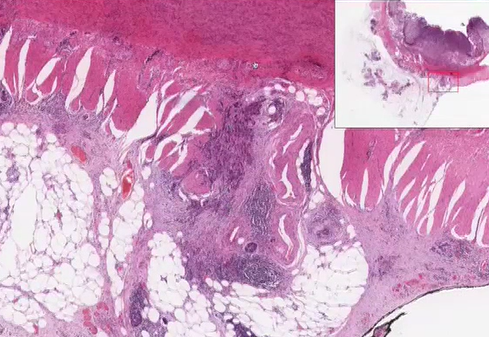 | Patho-Bilder | Repetico