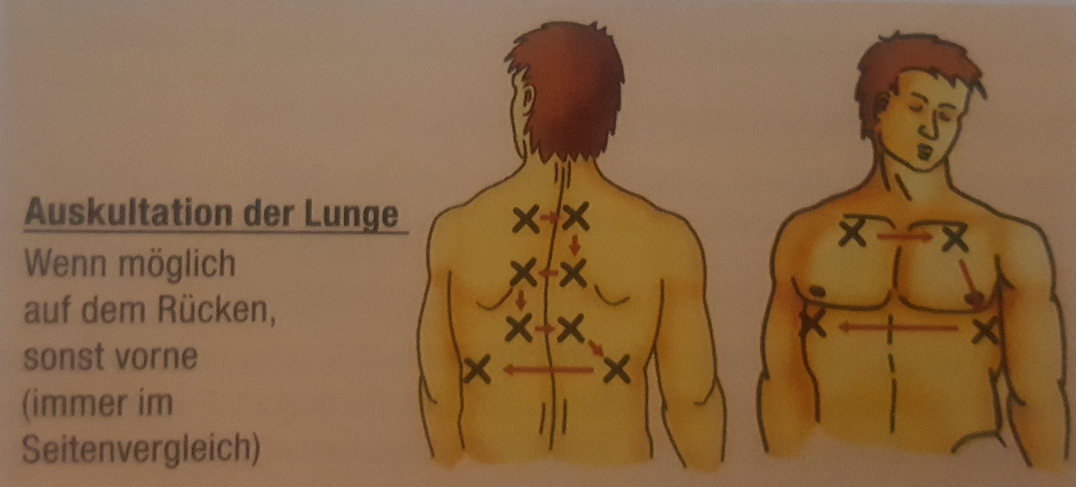 Erläutern Sie das IPPAF-Schema. | Allgemeine Notfallmedizin…