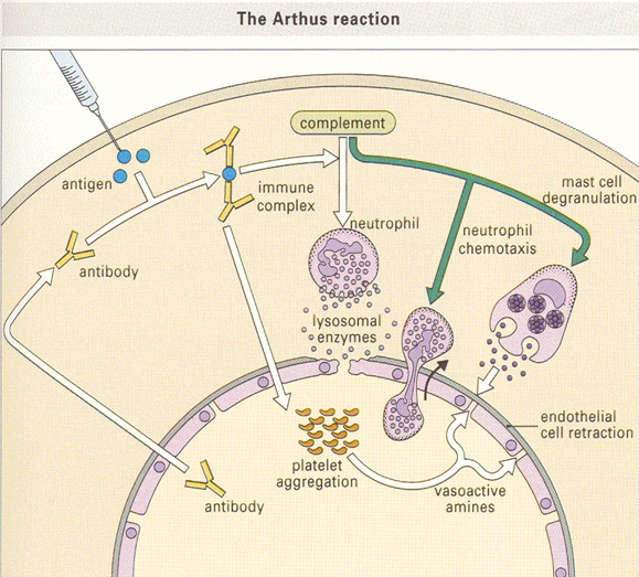 Was ist die Arthus-Reaktion? | Immu Rink | Repetico