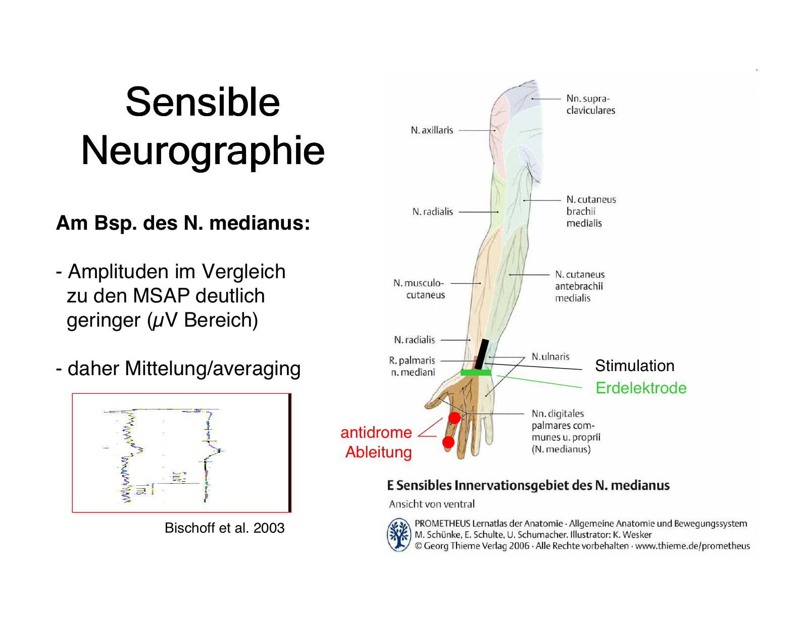 Erkläre die sensible Neurographie am Beispiel der N. Median…