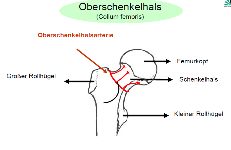 Oberschenkelhalsbruch, wie sieht er aus? | Grundlagen der Medizin für Ingenieure | Repetico