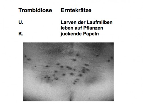 Trombidiose | Dermatologie II | Repetico