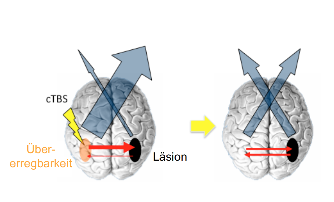 Therapeutische Applikation der NIHSBeispiel: visueller Negl…