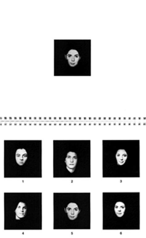Agnosien Diagnostik der Gesichterwahrnehmung Benton Facia…