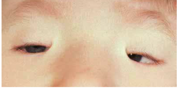 ? Um welches Krankheitsbild handelt es sich in derAbb.1.7